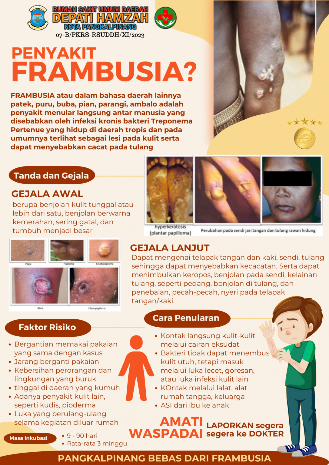 Mengenal Apa Itu Frambusia, Gejala, dan Cara Mengobatinya – RSUD Depati Hamzah